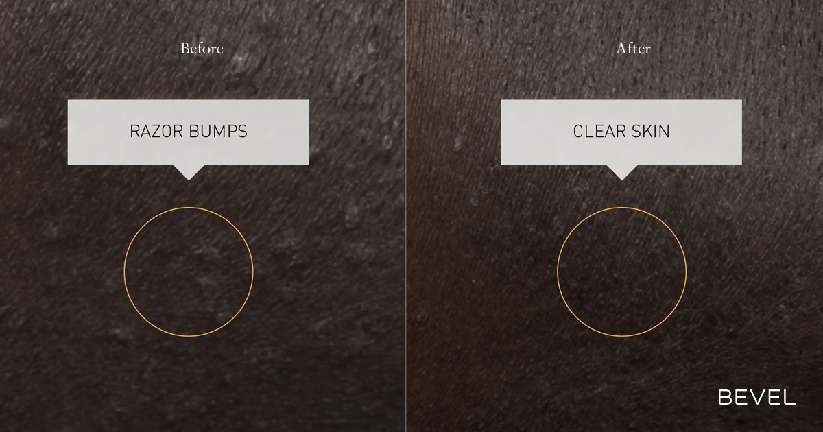 For All Skin Types: Bevel Shave System & Trimmer | Bevel